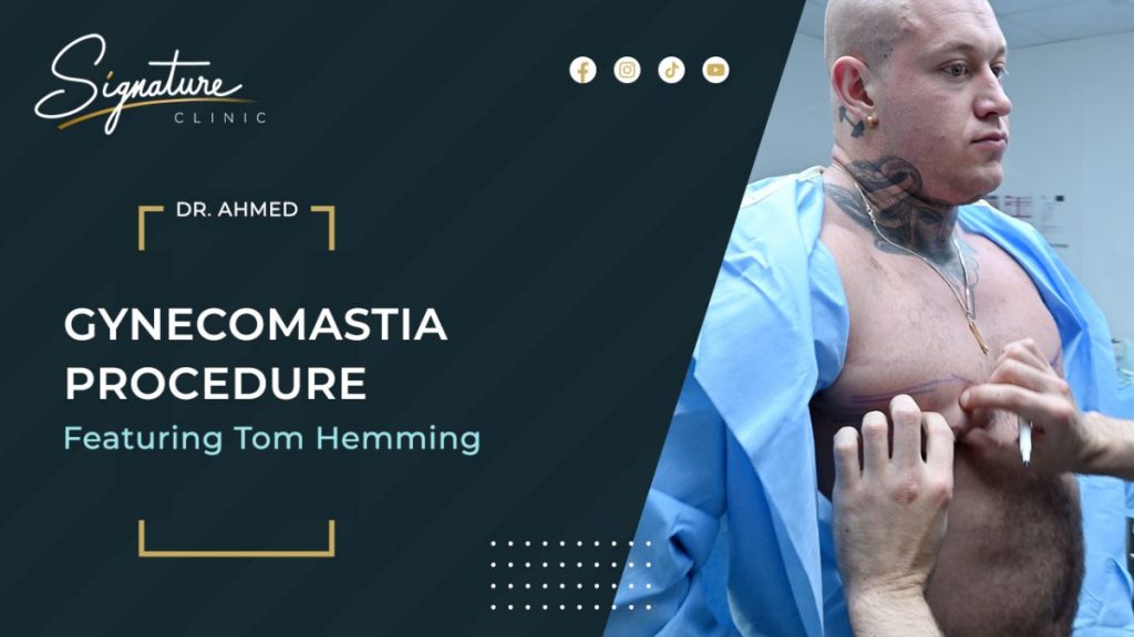 Bodybuilder Undergoes Gynecomastia Surgery - Signature Clinic
